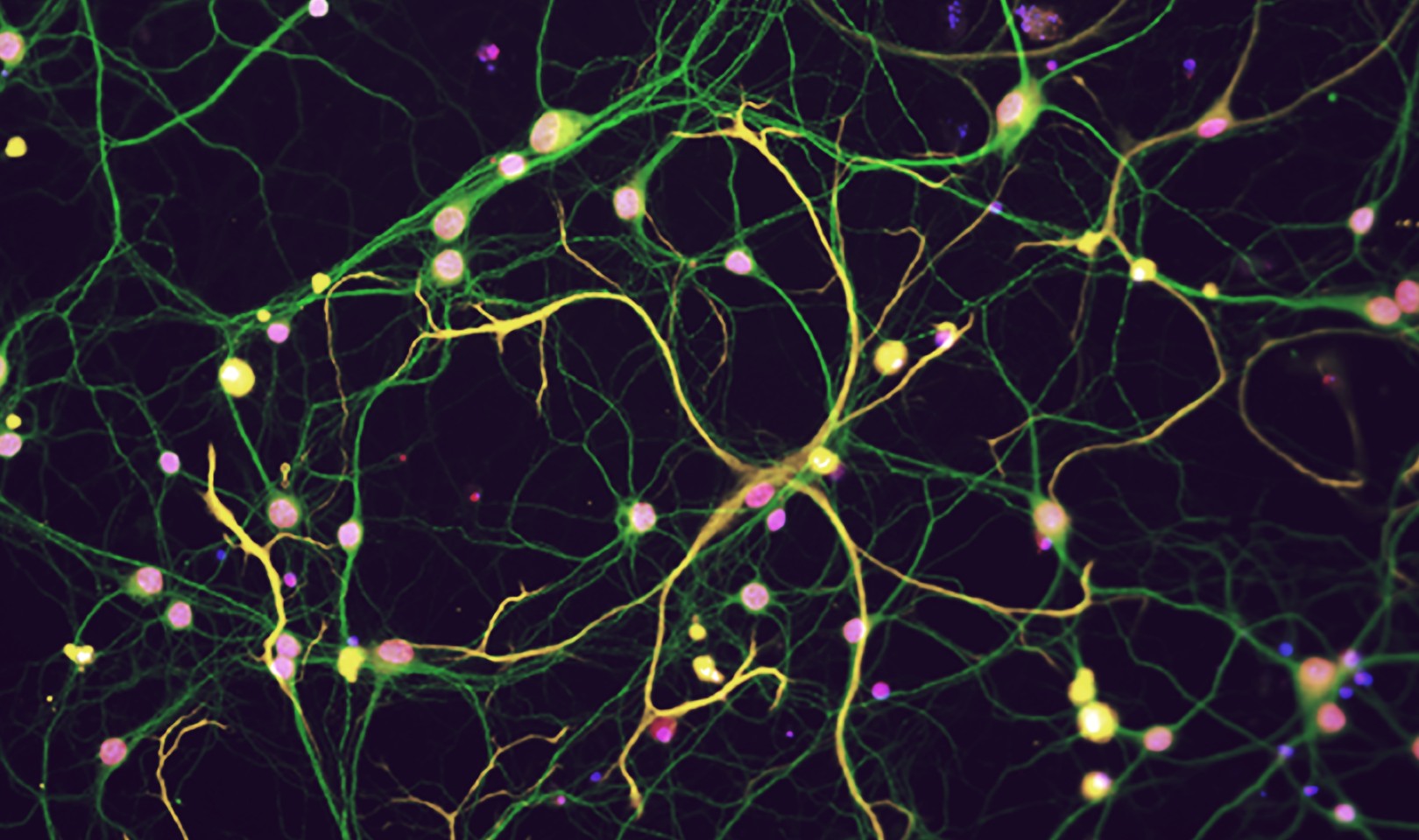AC Immune SA | Precision medicine for neurodegenerative diseases